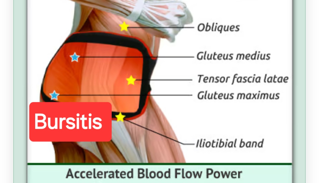 What is Bursitis | Living Abroad